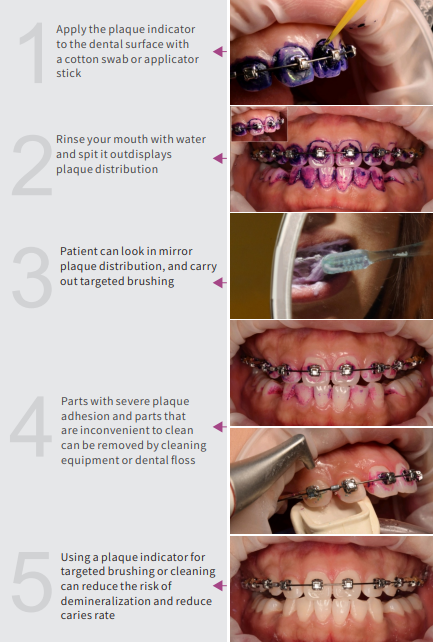Grape Flavor Two Color Dental Plaque Indicator To Lock In Place Of ...